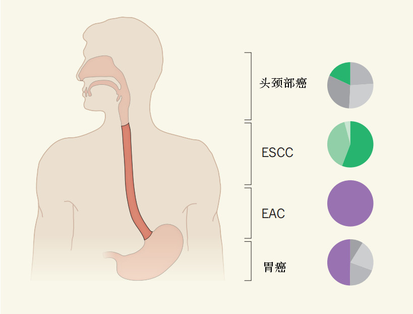 食管癌新分类 | 生命奥秘